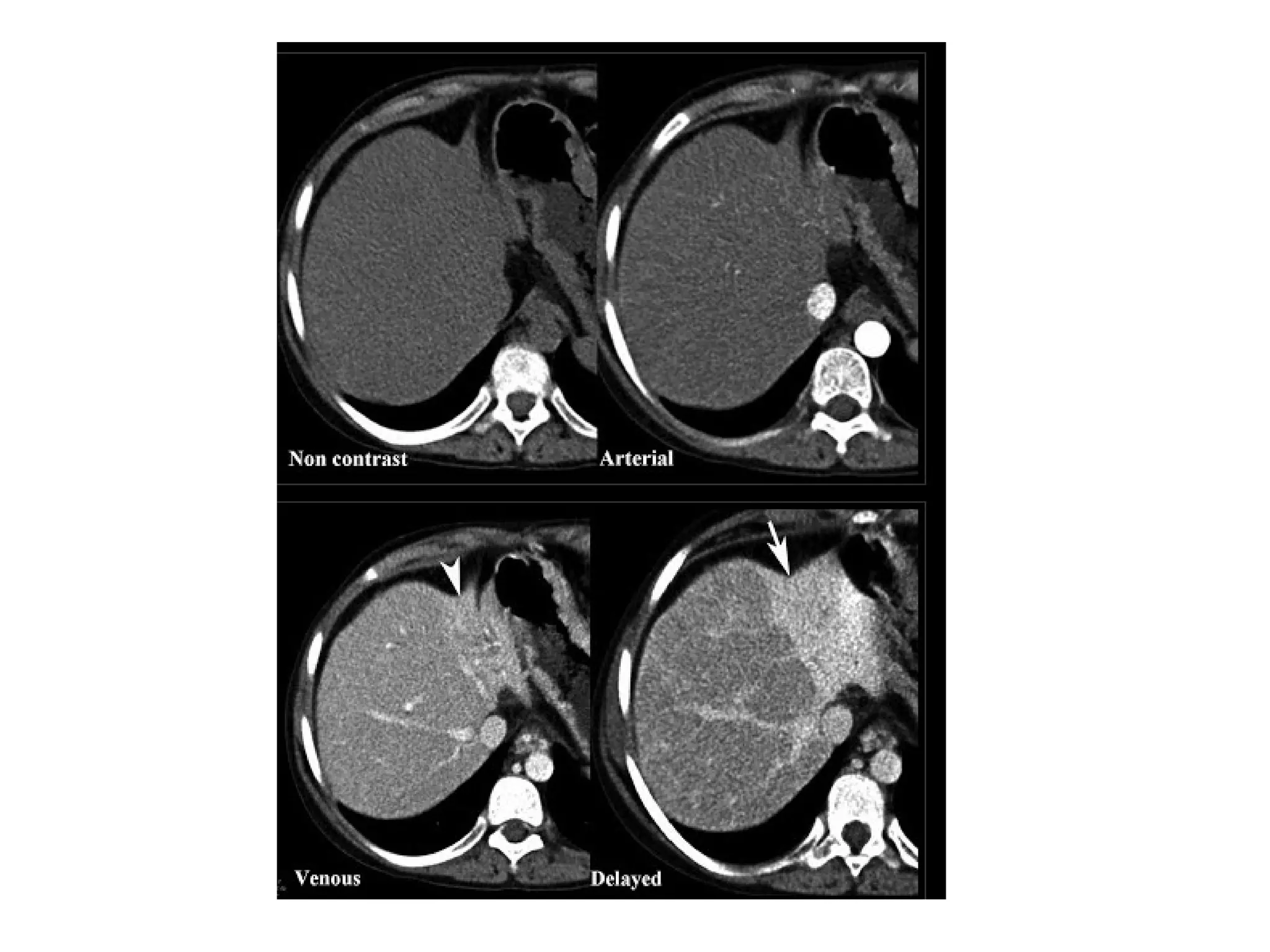 Diagnostic Imaging of the Liver | PPT