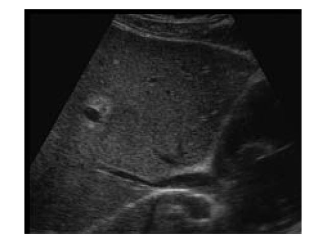 Diagnostic Imaging of the Liver | PPT