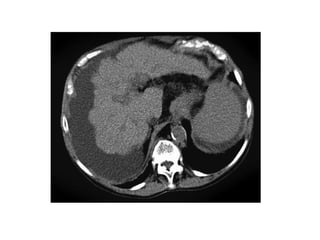 Diagnostic Imaging of the Liver | PPT