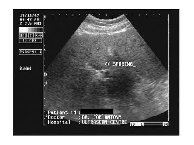 Diagnostic Imaging of the Liver | PPT