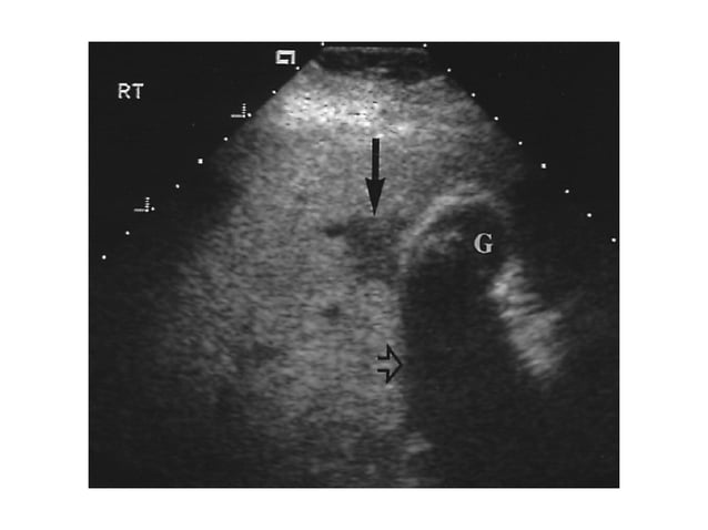 Diagnostic Imaging of the Liver | PPT