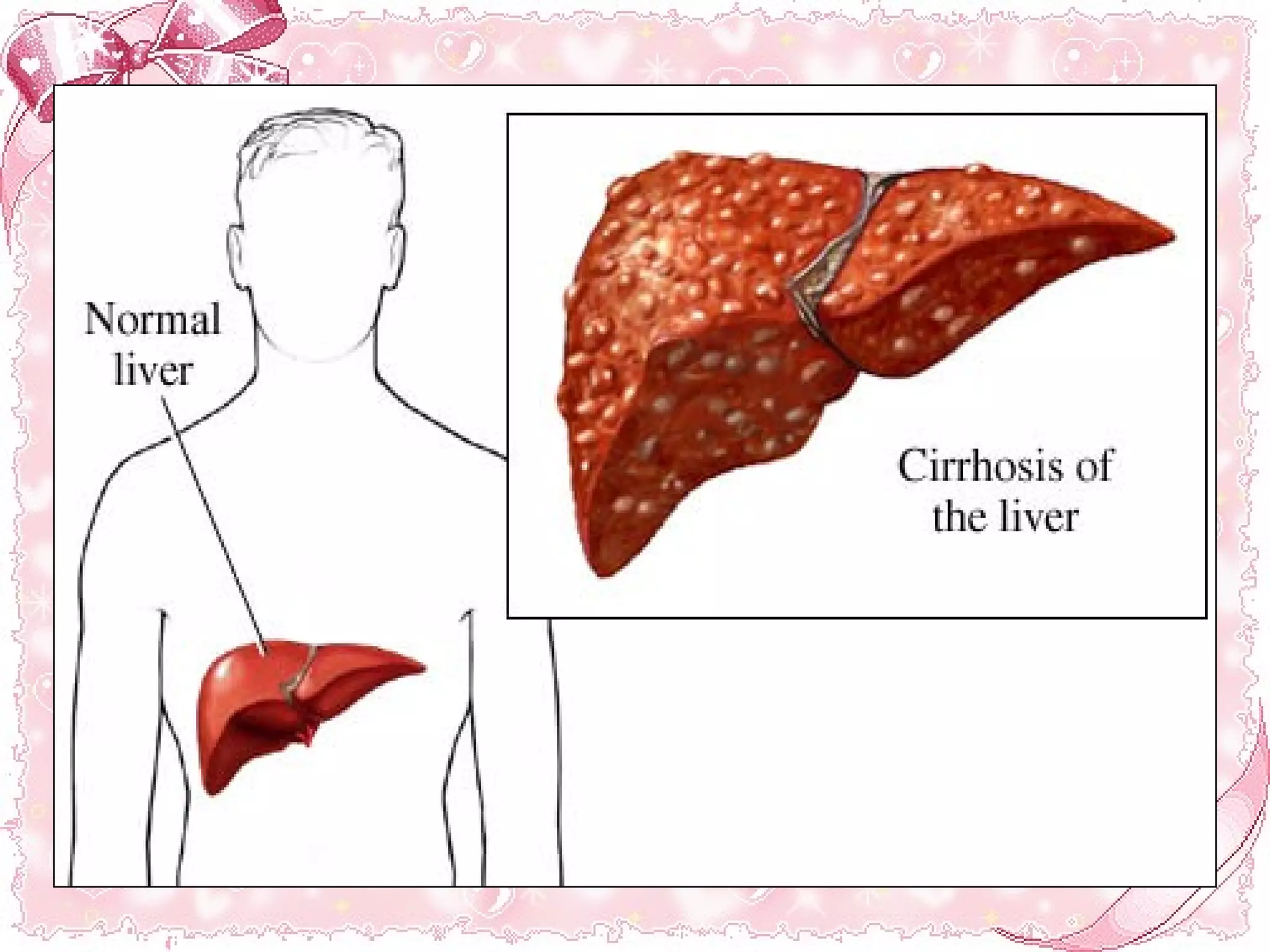 Liver | PPT