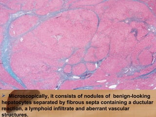 Recent Advances:Hepatocellular Nodules | PPT