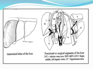 Liver Disease in General Surgery | PPTX