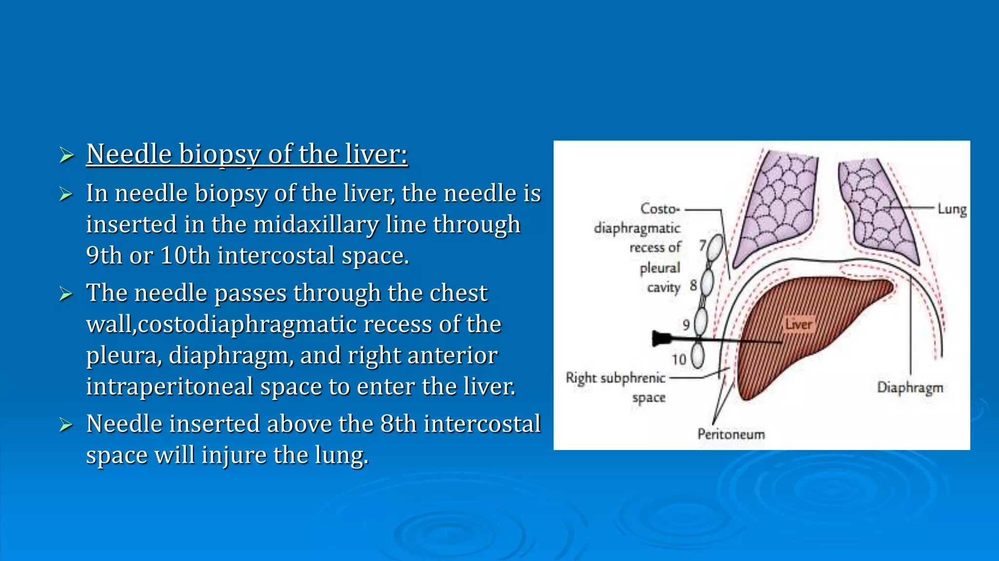 Liver | PPTX