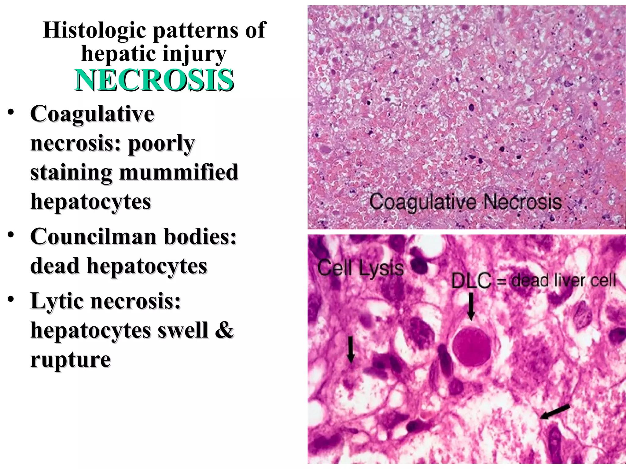LIVER PATHOLOGY | PPT