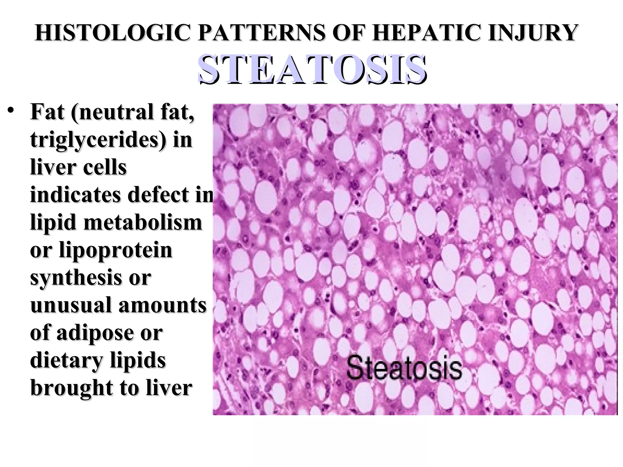 LIVER PATHOLOGY | PPT