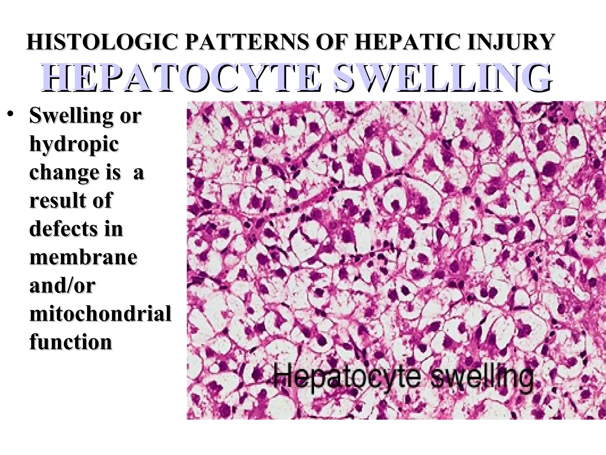 LIVER PATHOLOGY | PPT