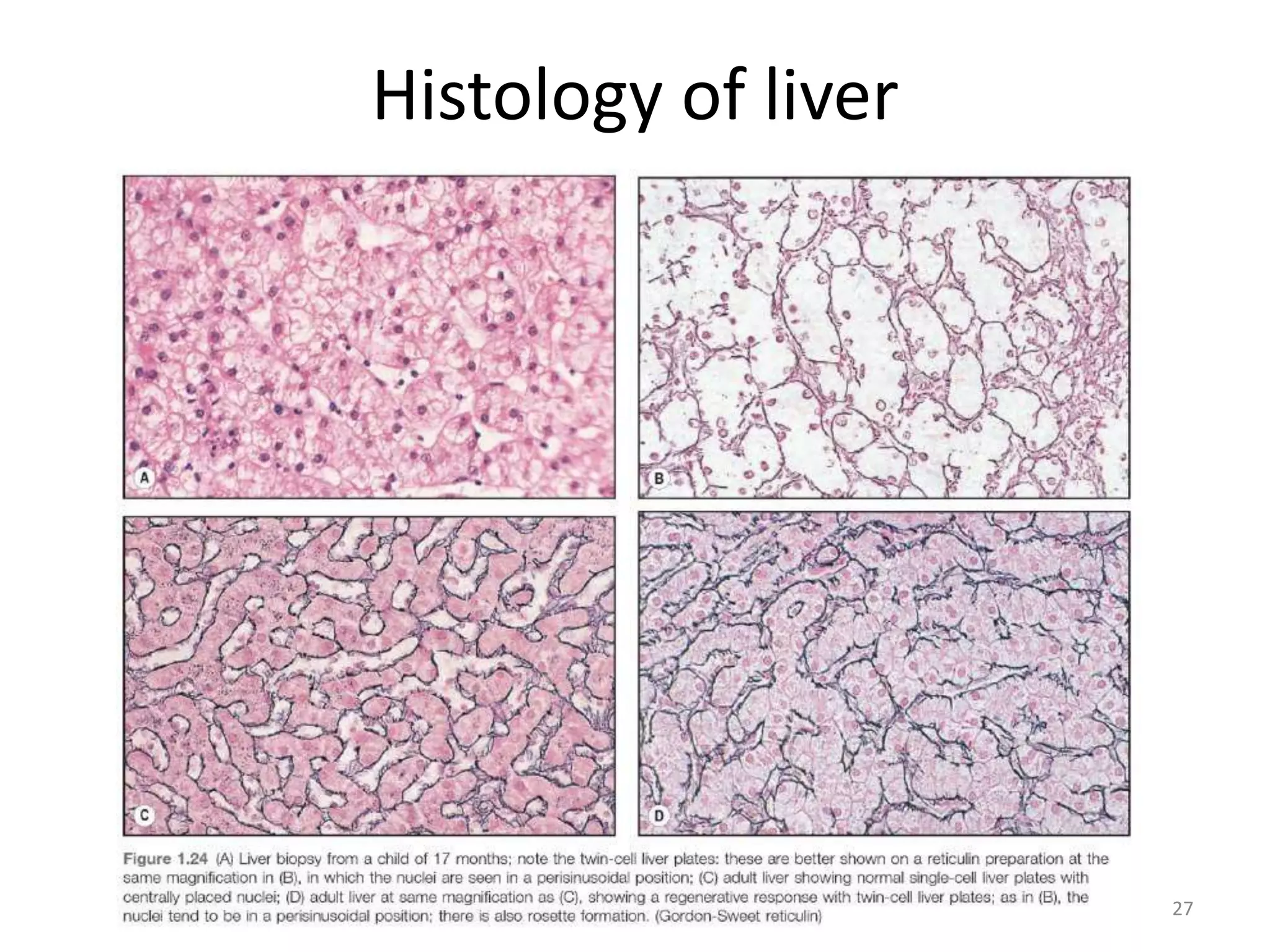 ALD, Cirrhosis, PBC and PSC | PPTX