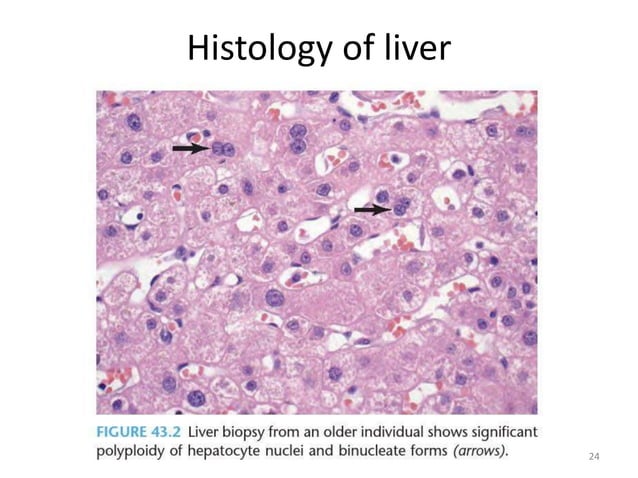 ALD, Cirrhosis, PBC and PSC | PPTX