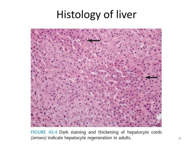 ALD, Cirrhosis, PBC and PSC | PPTX