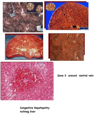 pathology photo | PDF