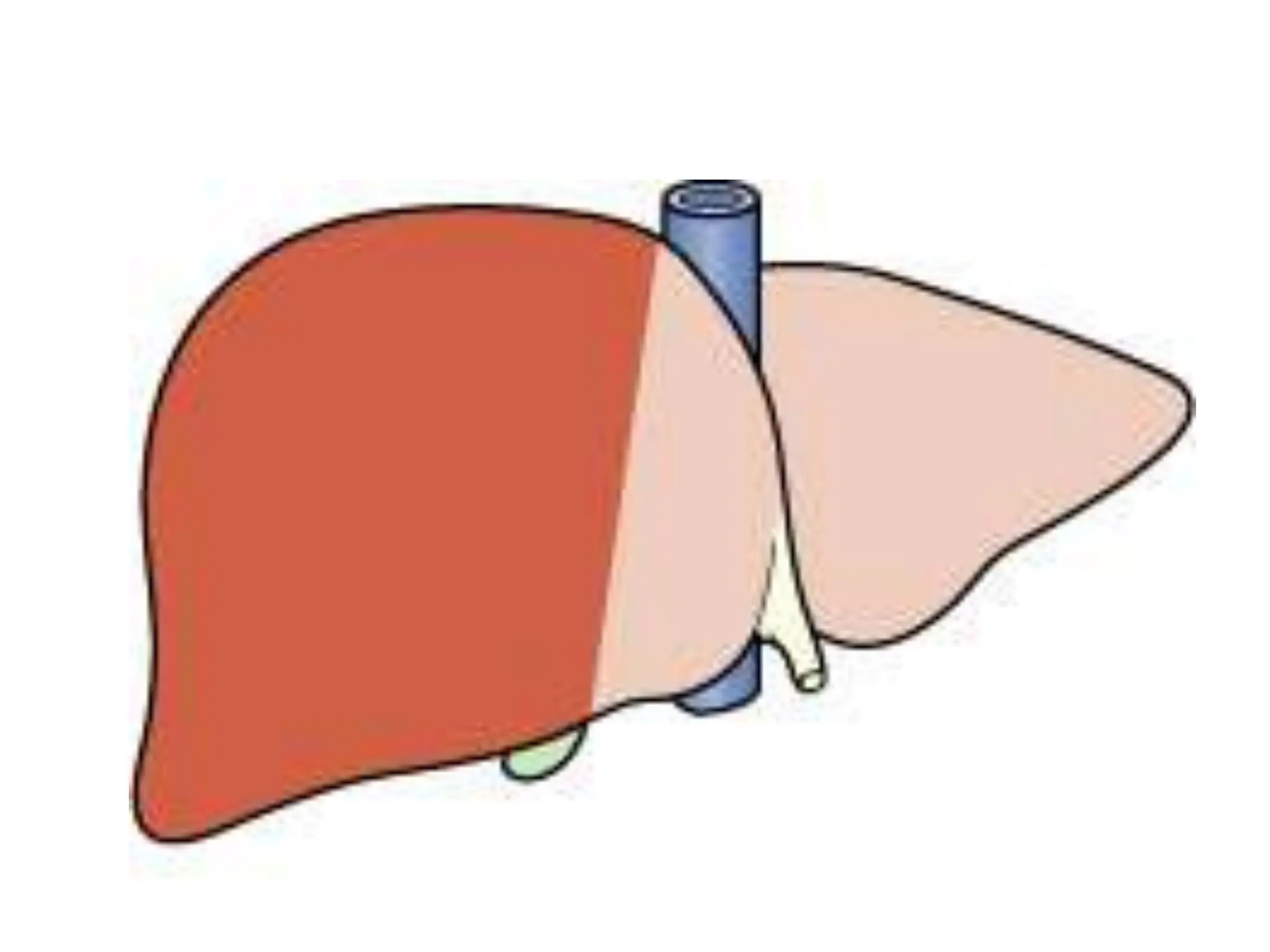 Liver Anatomy and Surgery- A guide towards liver resection | PPT