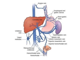 Liver Anatomy and Surgery- A guide towards liver resection | PPT