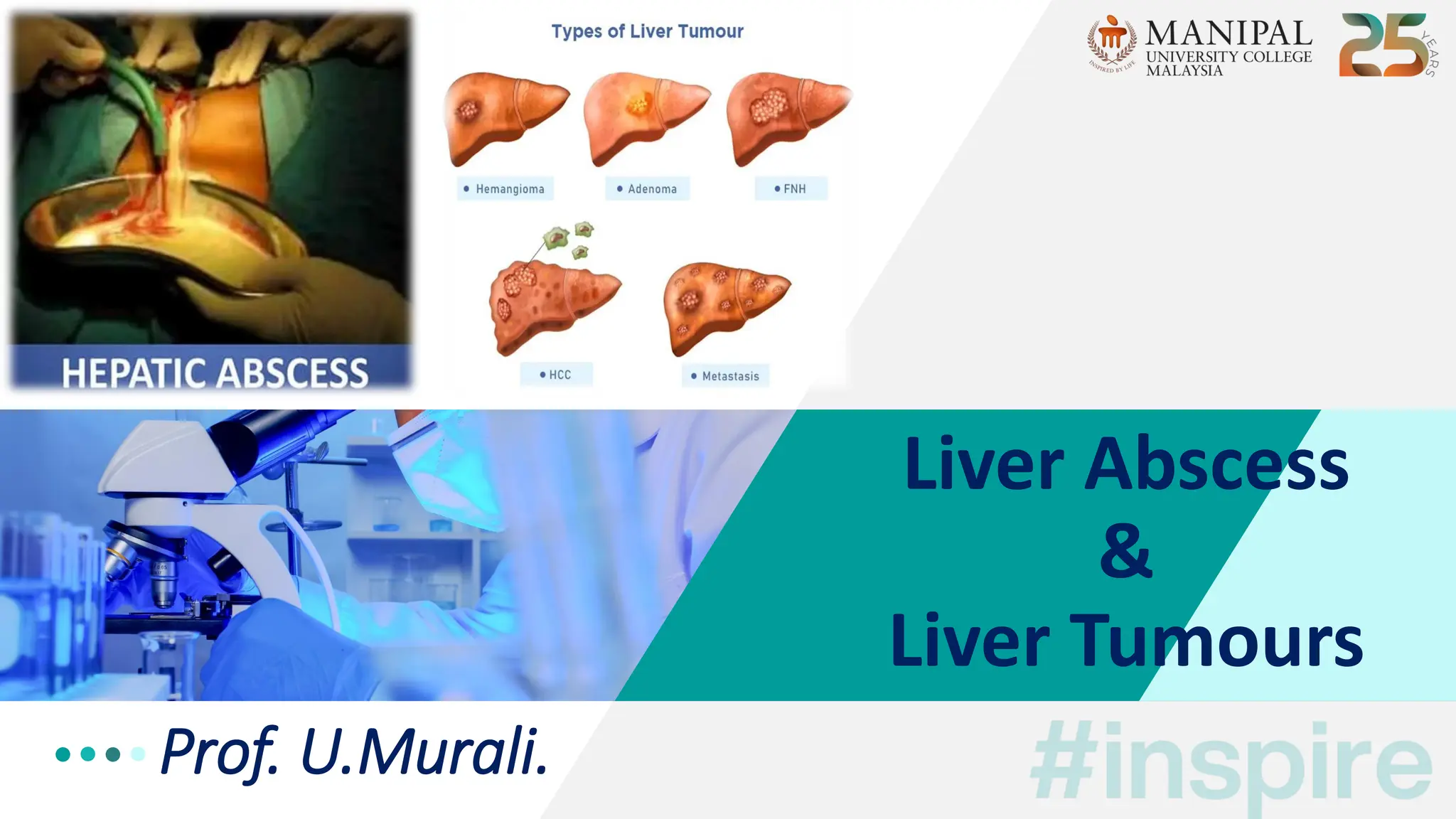 Liver - Surgical Anatomy, Abscess and Liver - Tumours | PDF