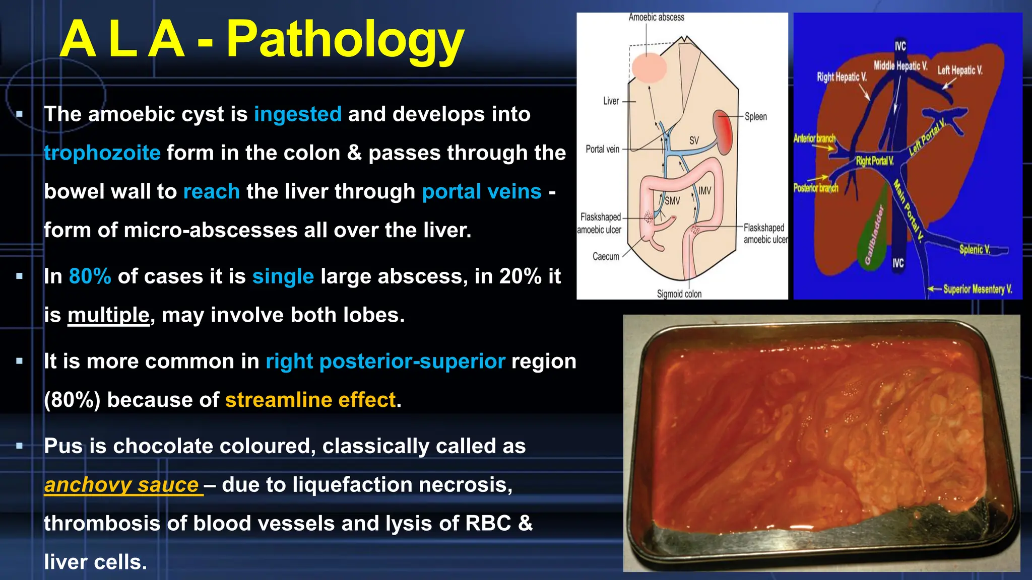 Liver - Surgical Anatomy, Abscess and Liver - Tumours | PDF