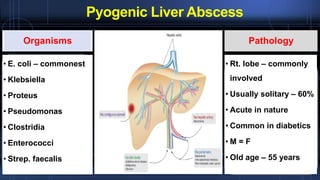 Liver - Surgical Anatomy, Abscess and Liver - Tumours | PDF