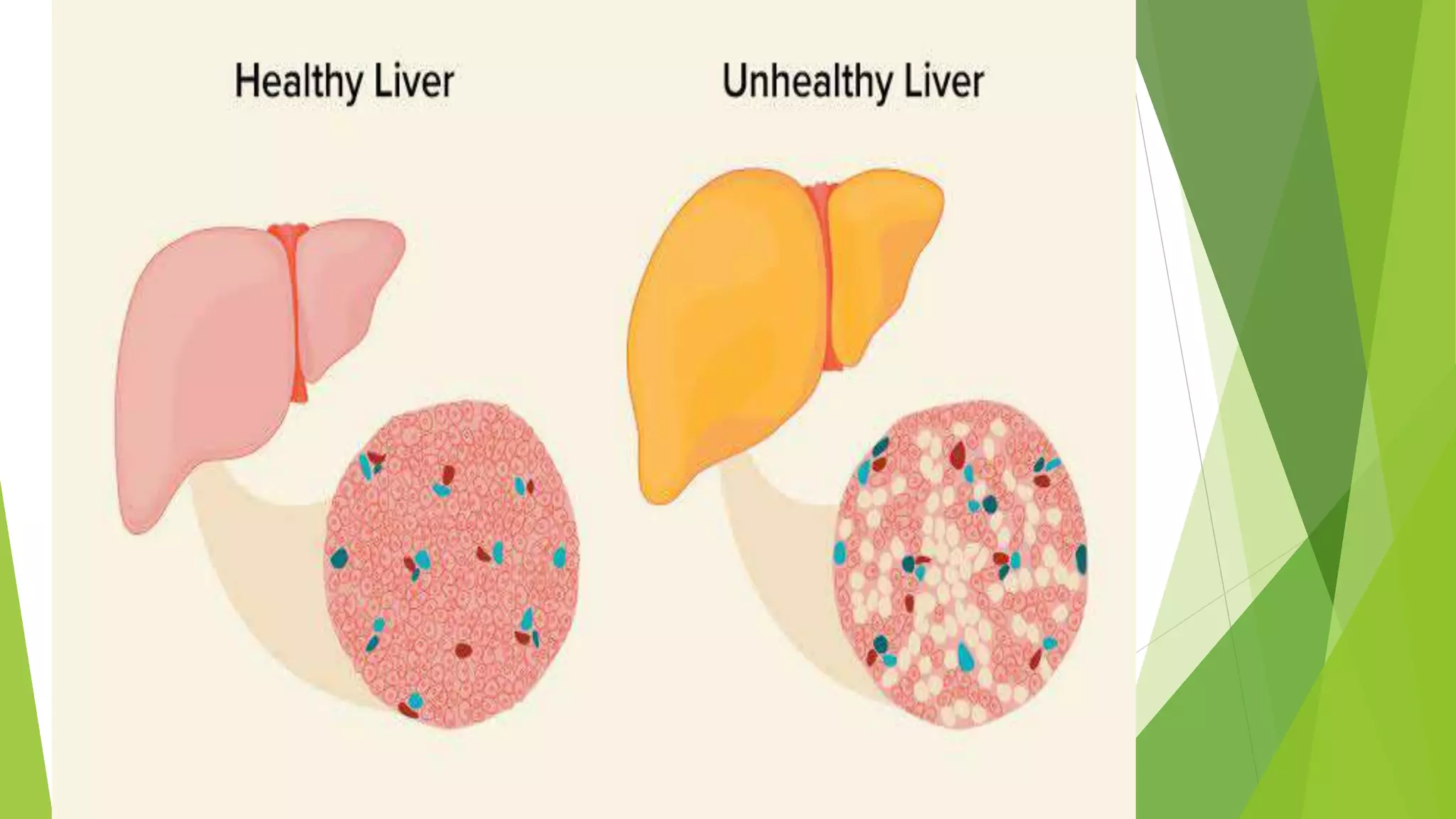 liver-assessments.pptx