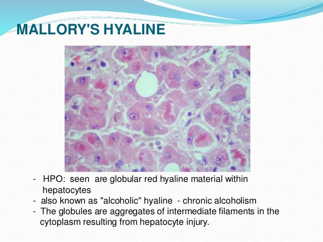 Liver surgical pathology