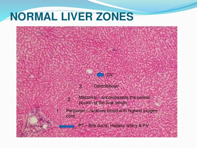 Liver surgical pathology