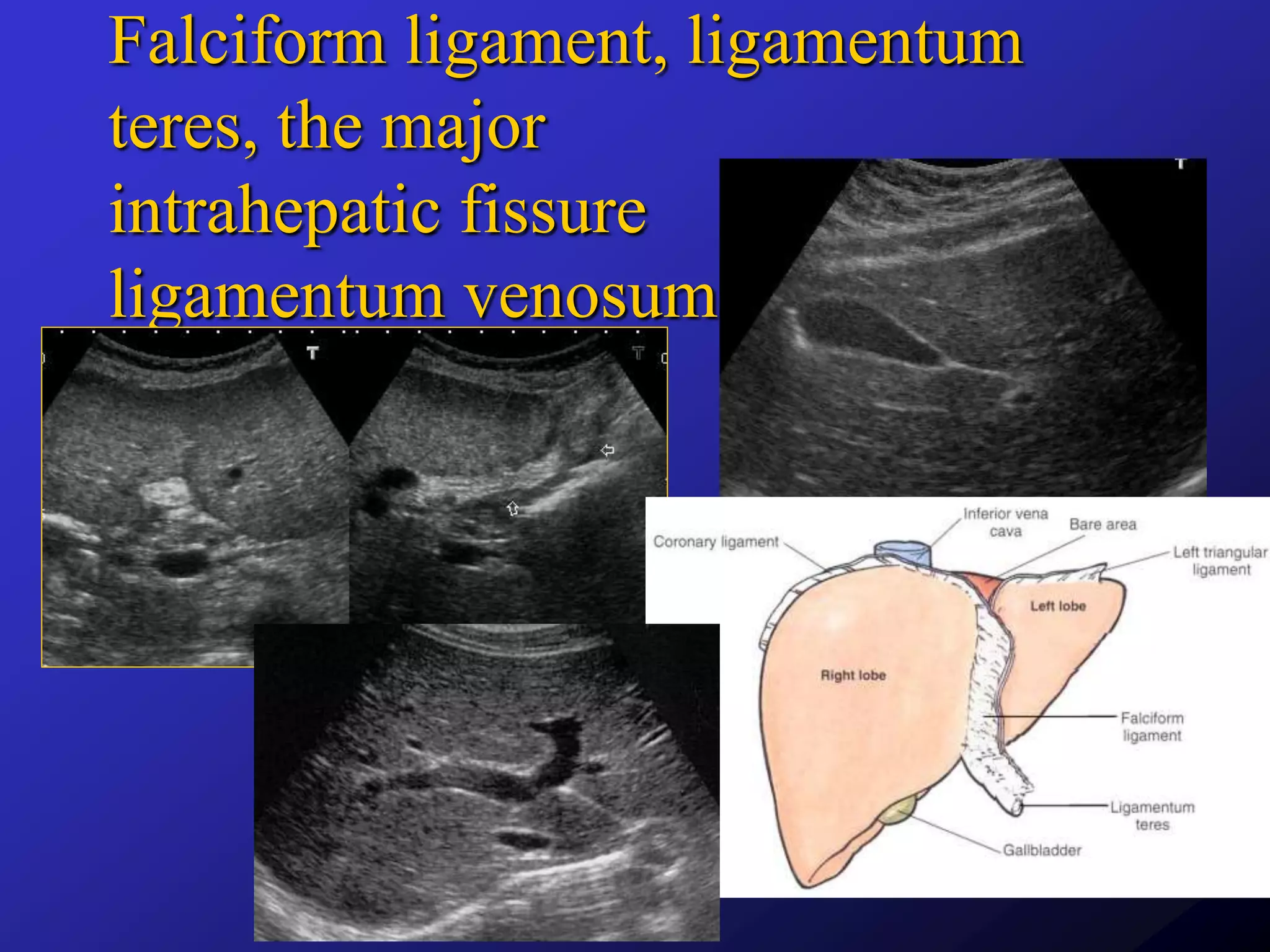 Liver ultrasound, step by step, part 1 | PPTX
