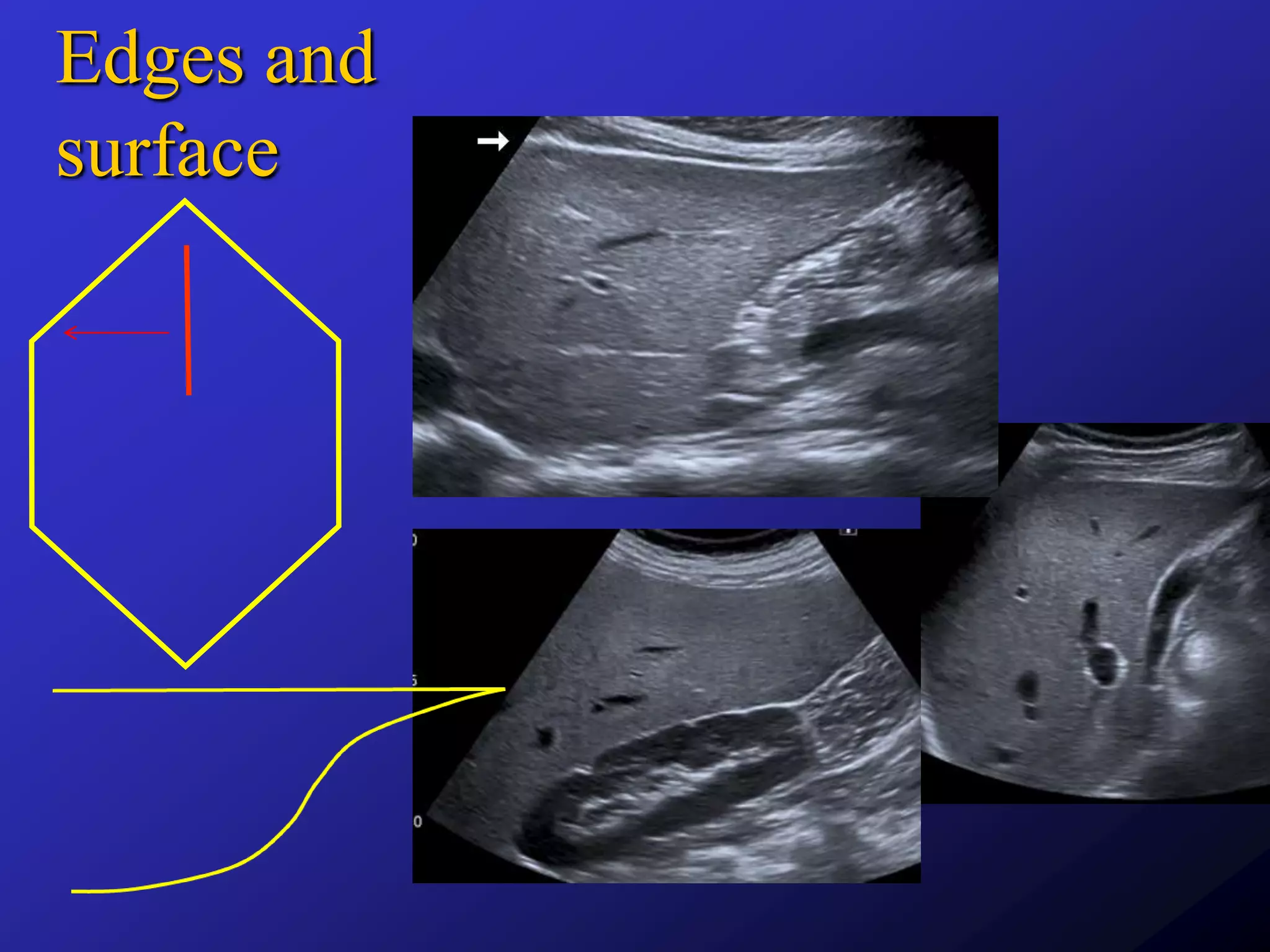 Liver ultrasound, step by step, part 1 | PPTX