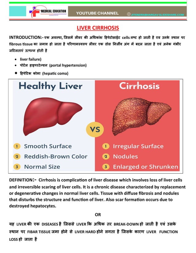 Liver cirrhosis medical surgical nursing notes in Jitendra bhargav ...
