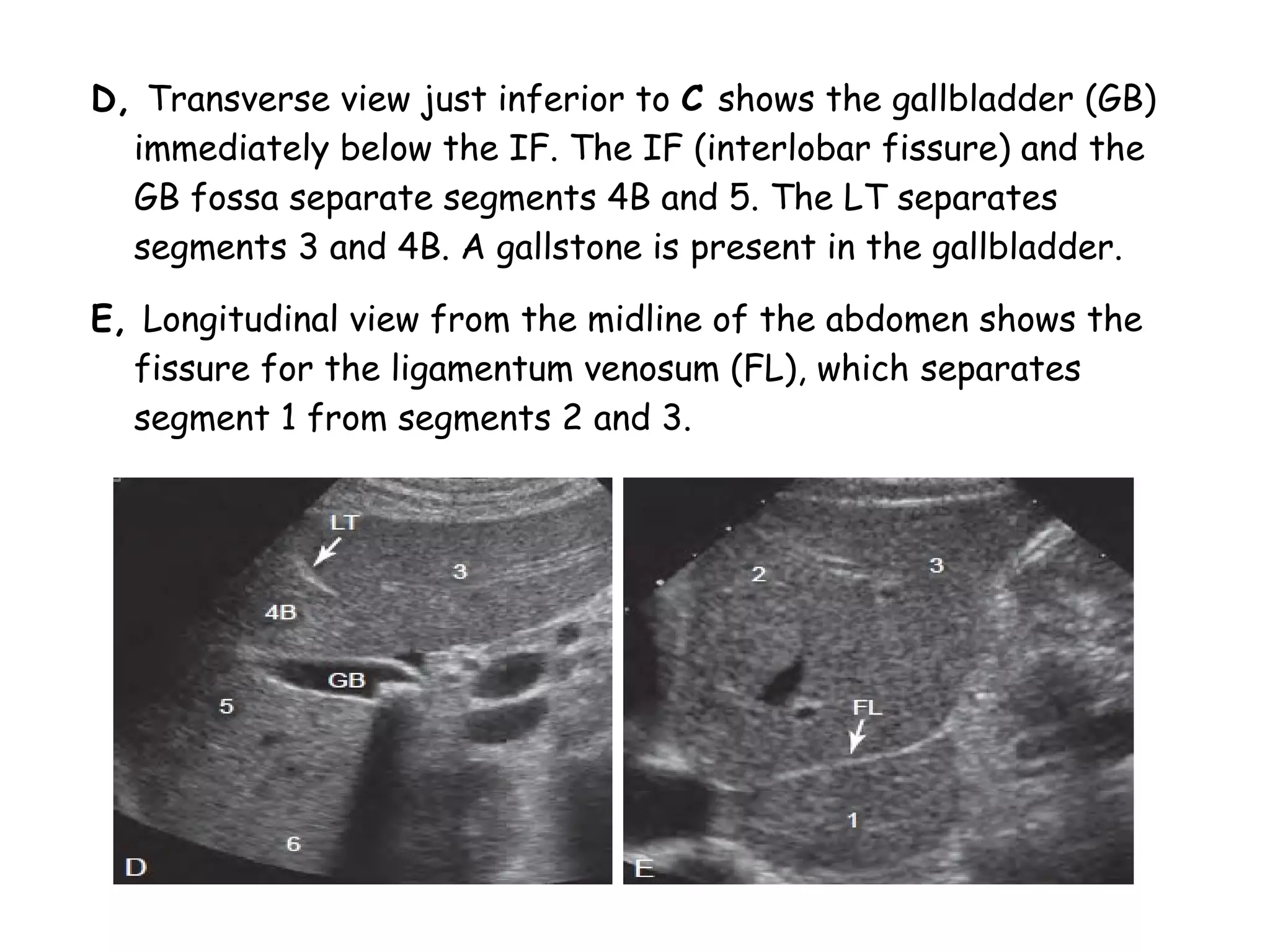Liver Ultrasound | PPT