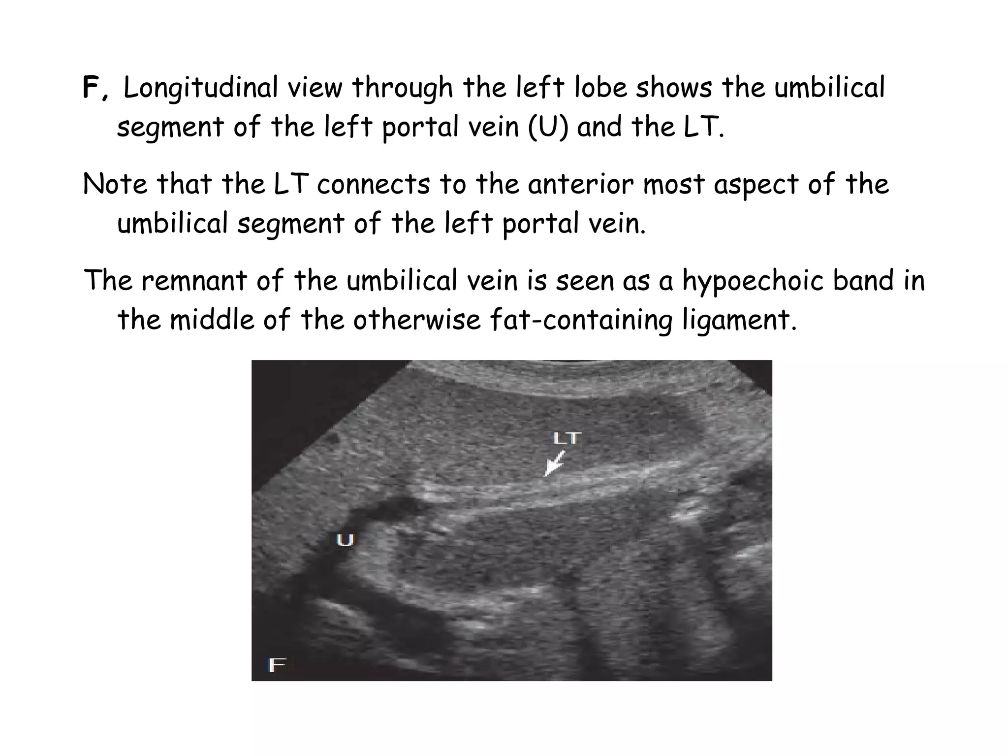 Liver Ultrasound | PPT