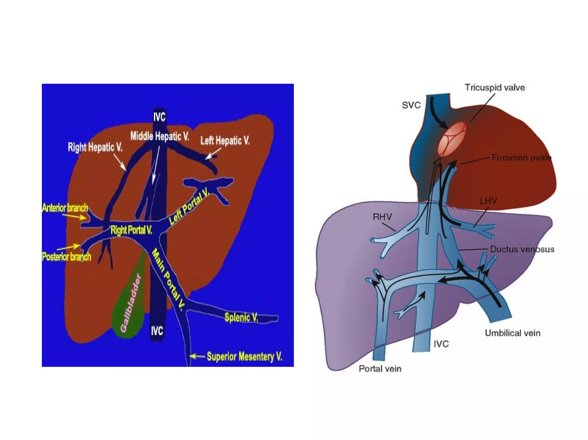 Liver Ultrasound | PPT