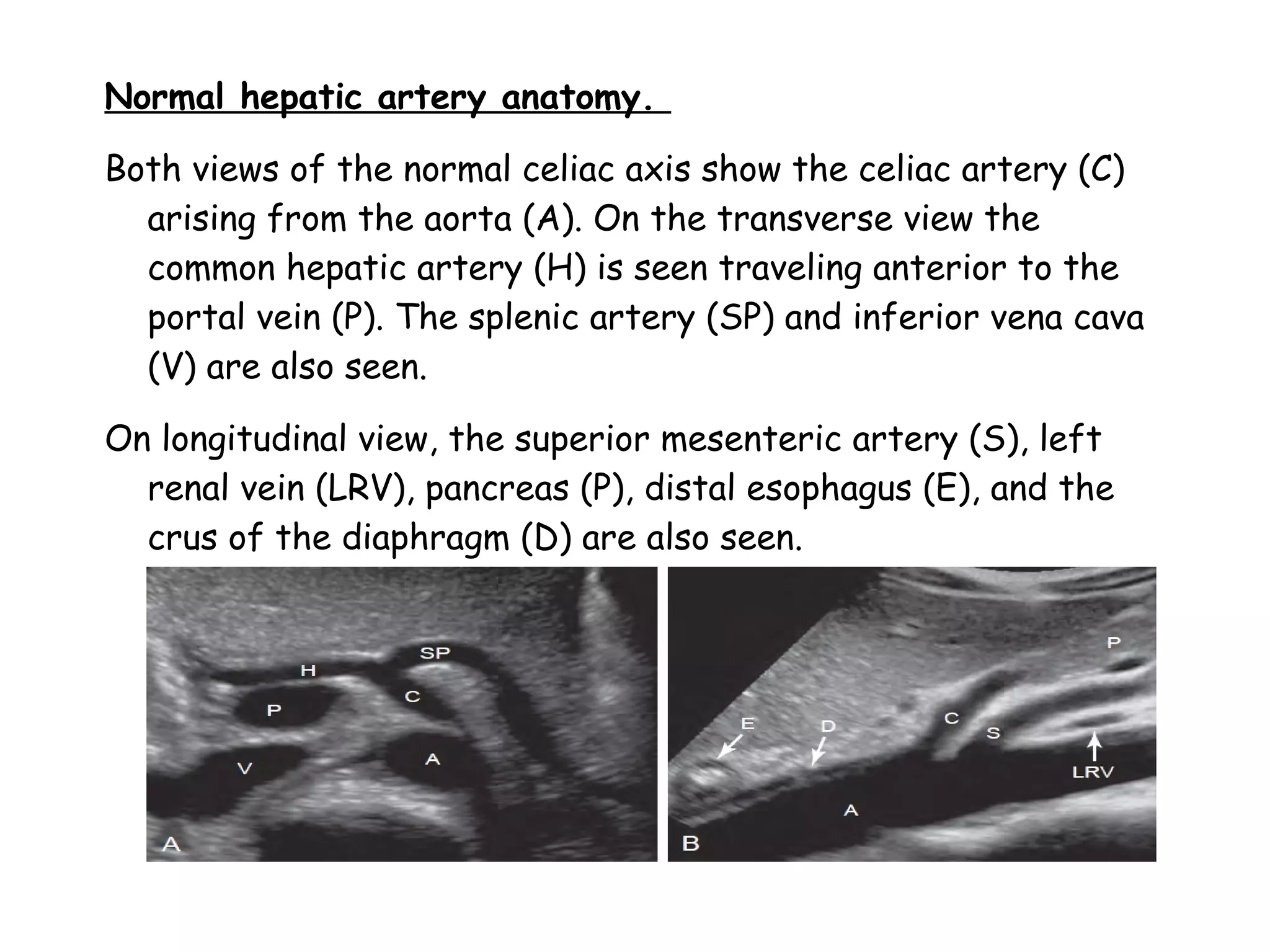 Liver Ultrasound | PPT