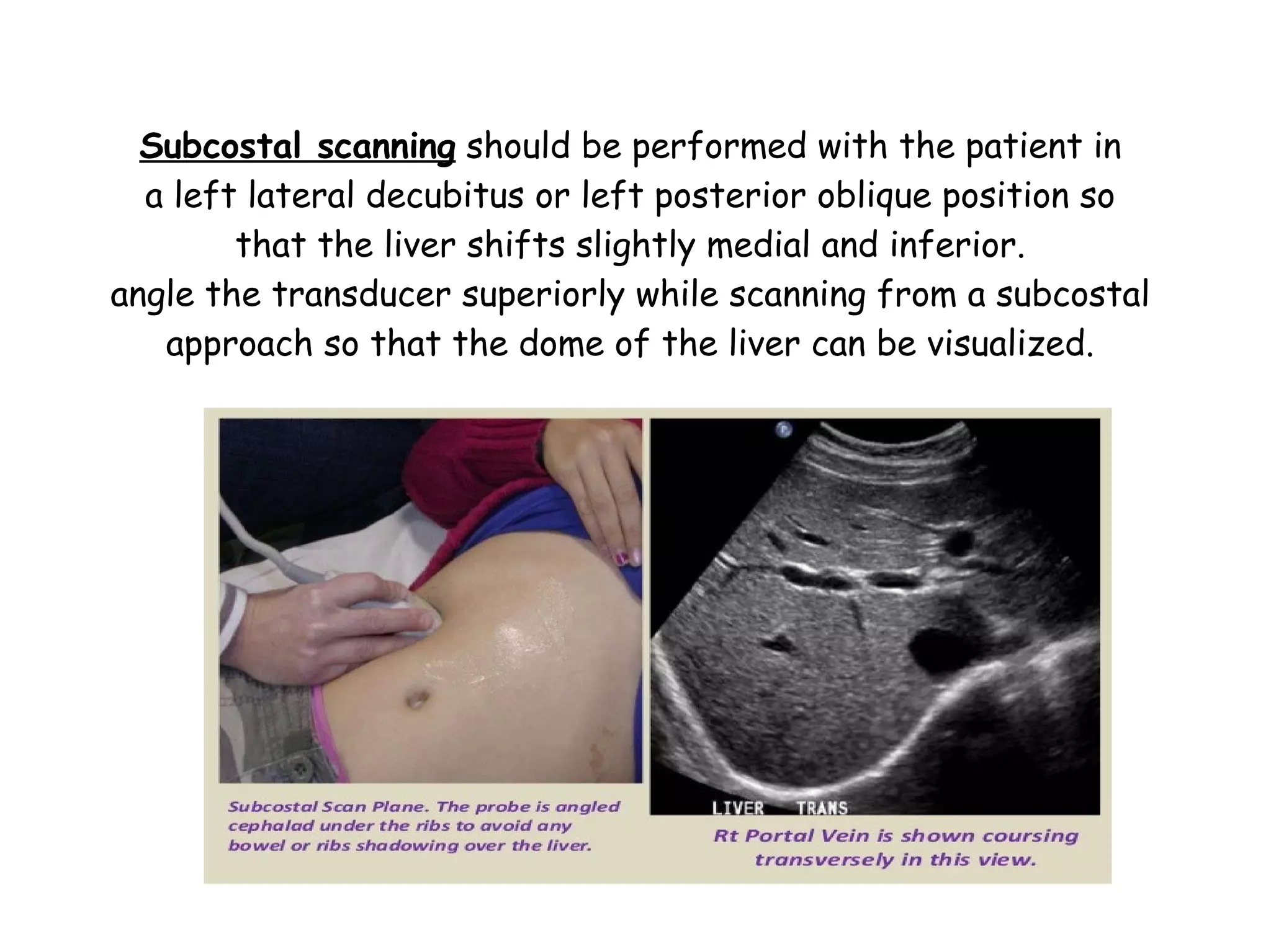 Liver Ultrasound | PPT