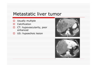 Liver abscess is a complication of amoebiasis and the .pdf