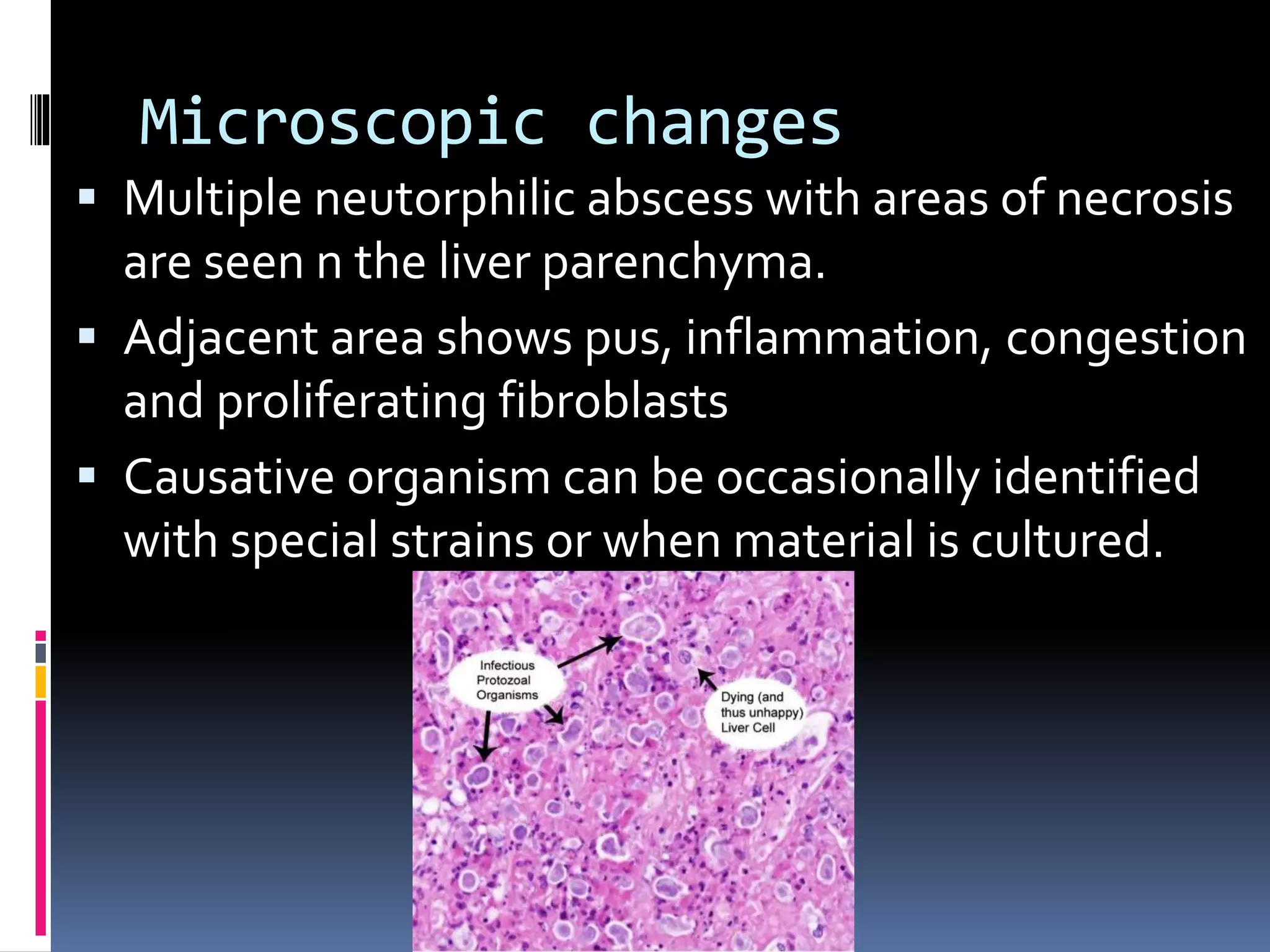 Liver abscess | PPTX