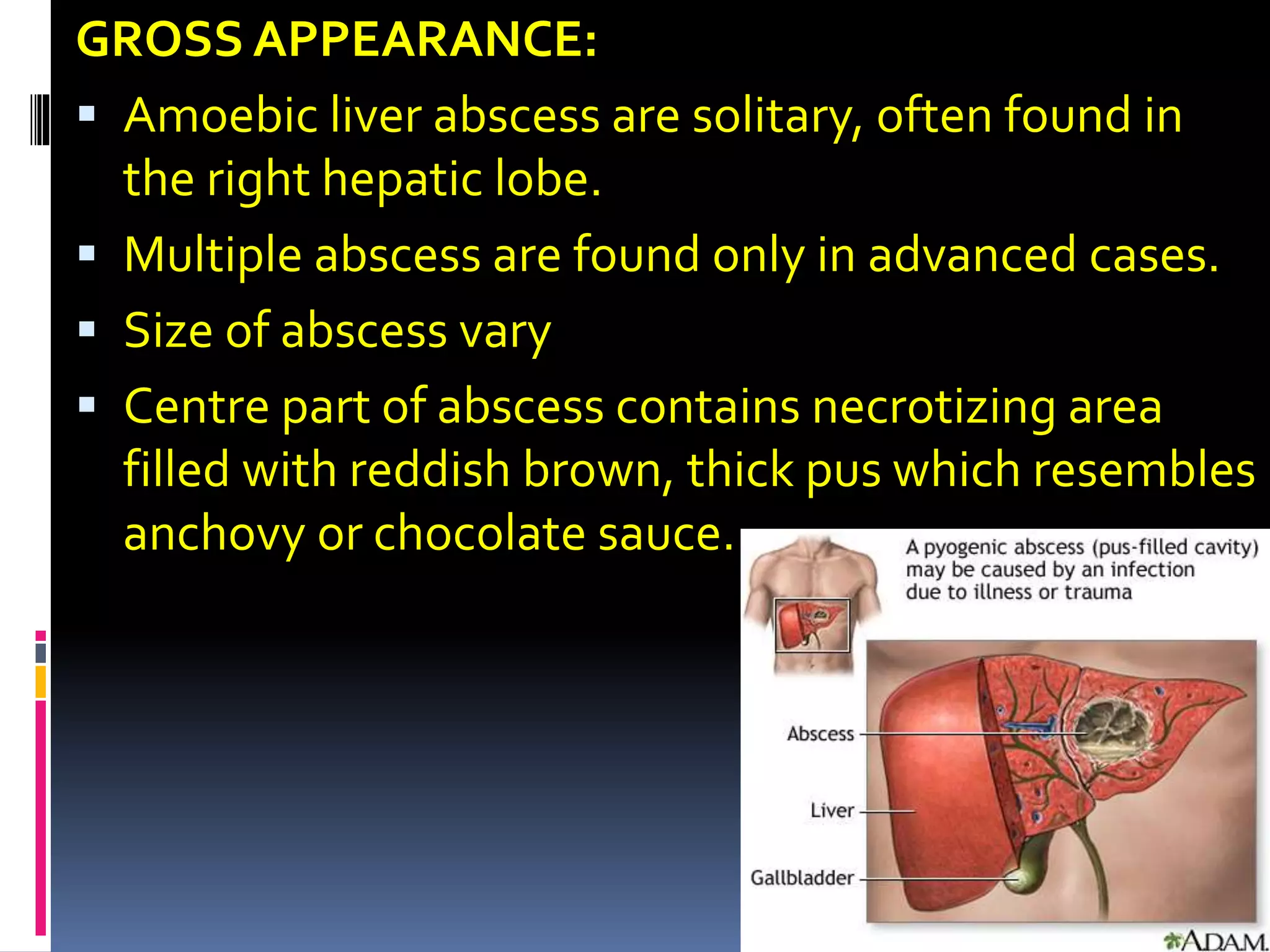 Liver abscess | PPTX