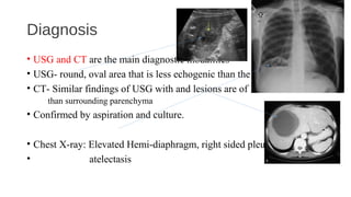 Liver abscess | PPT