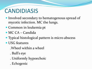 Liver abscess and comparision with different other abscess involving ...
