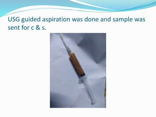 Liver abscess and comparision with different other abscess involving ...