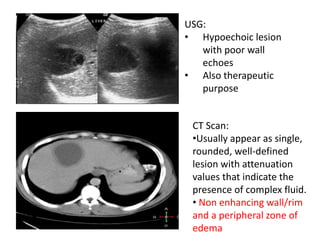 Liver abscess | PPTX