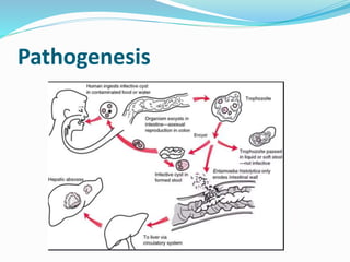Liver Abscess | PPTX