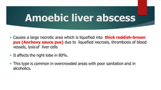 Liver abscess | PPT