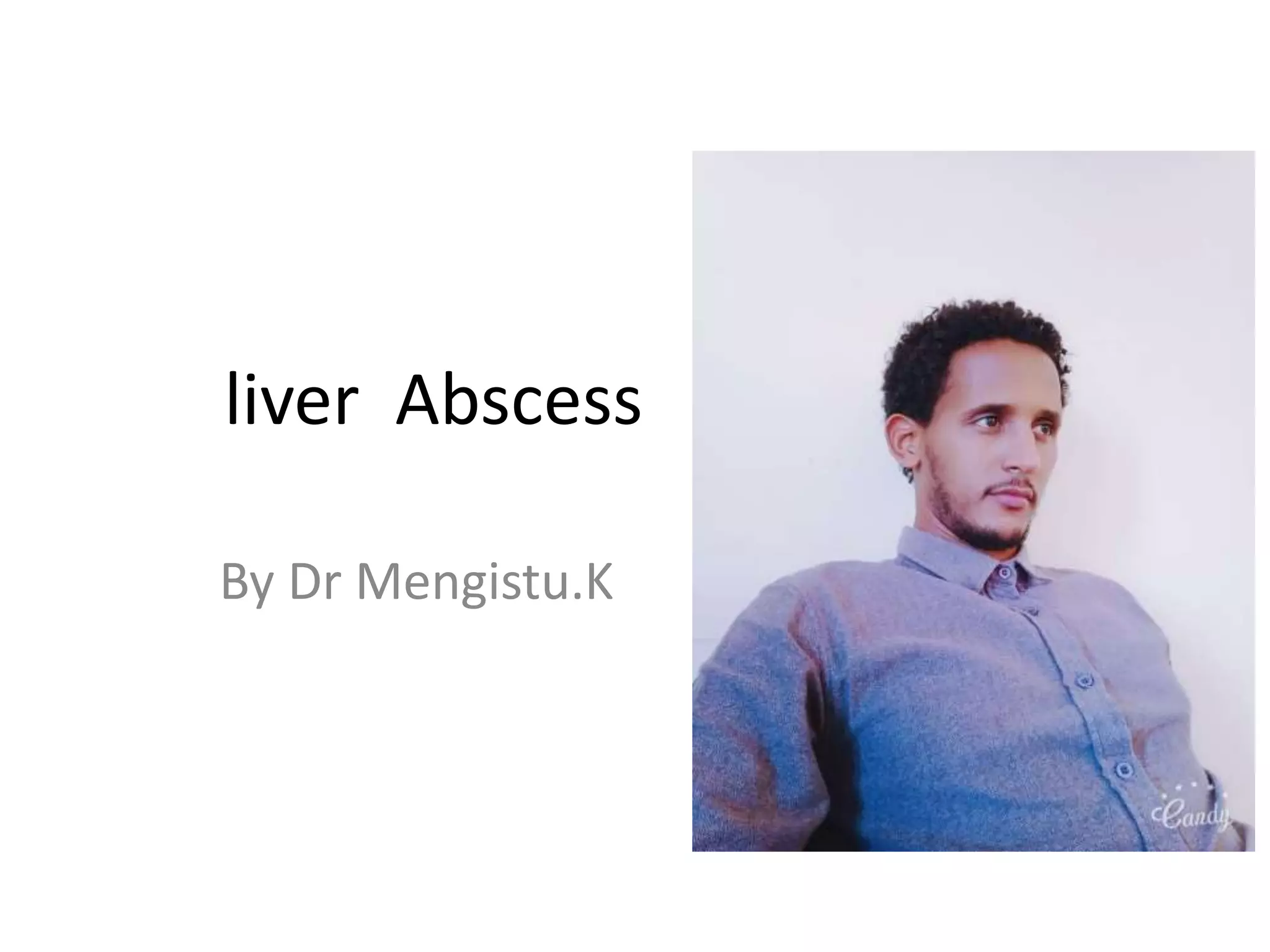 Liver abscess | PPTX