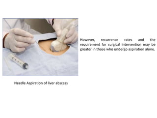 LIVER ABSCESS.pptx