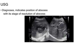 Liver abscess.pptx