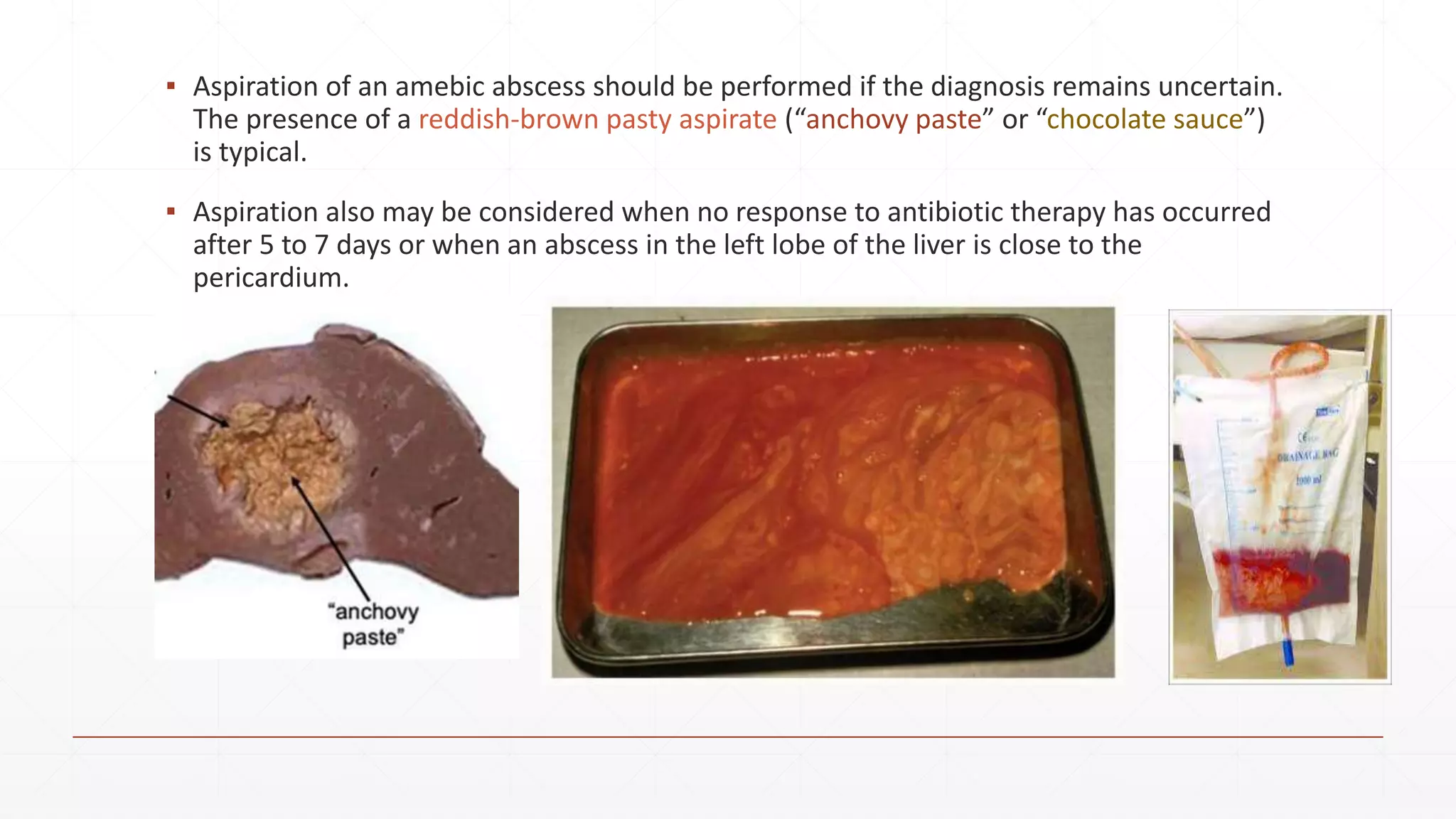 Liver Abscess.pptx