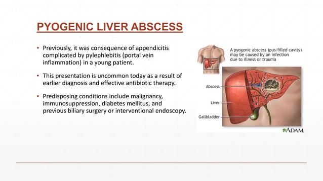 Liver Abscess.pptx