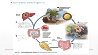 Liver Abscess.pptx
