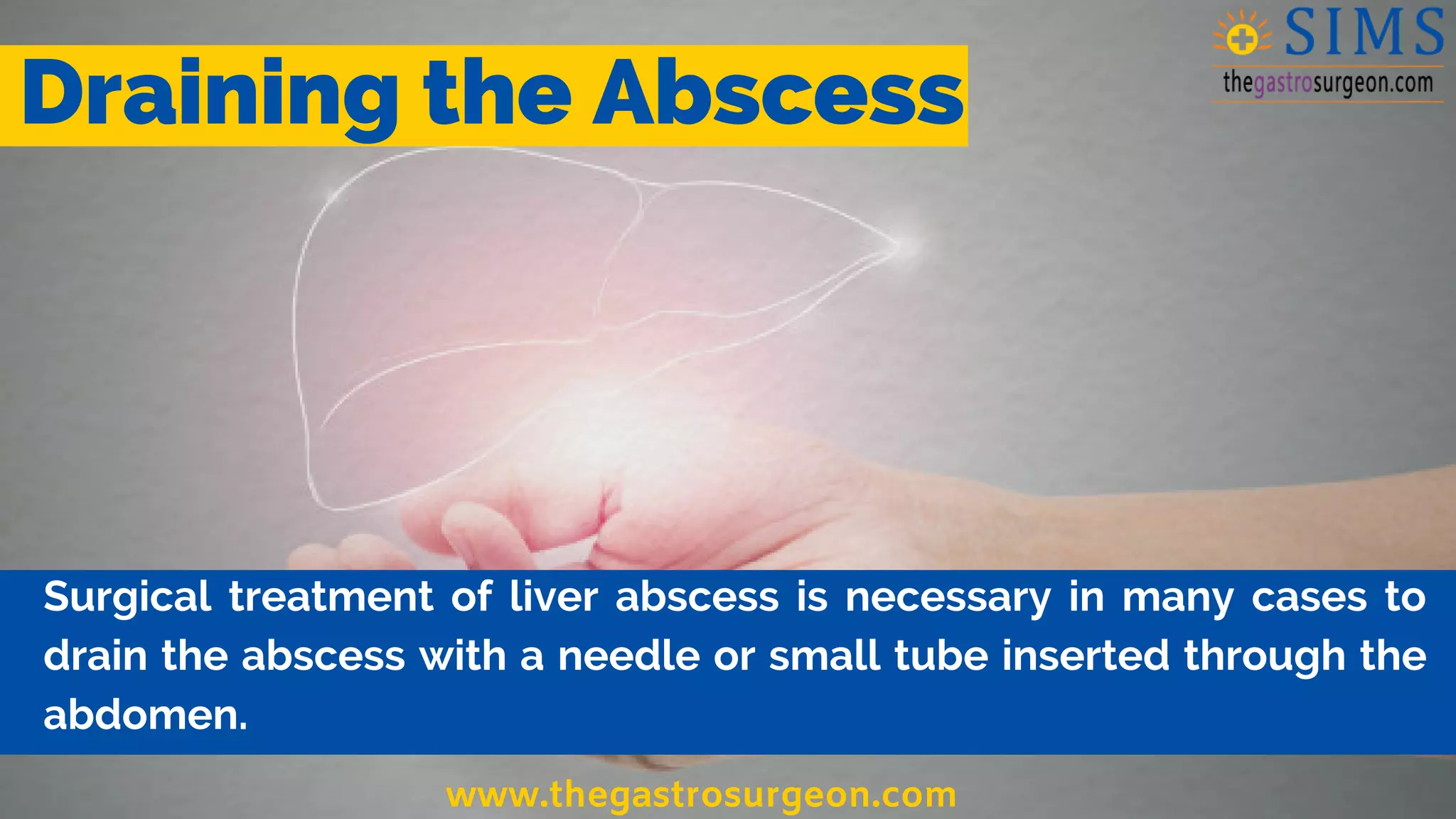 Liver abscess symptoms and treatment | PDF