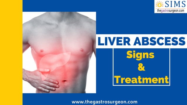 Liver abscess symptoms and treatment | PPT
