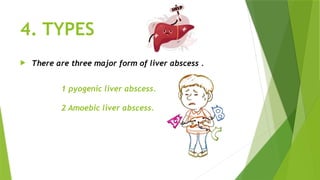 LIVER ABSCESS summary power point slides | PPTX